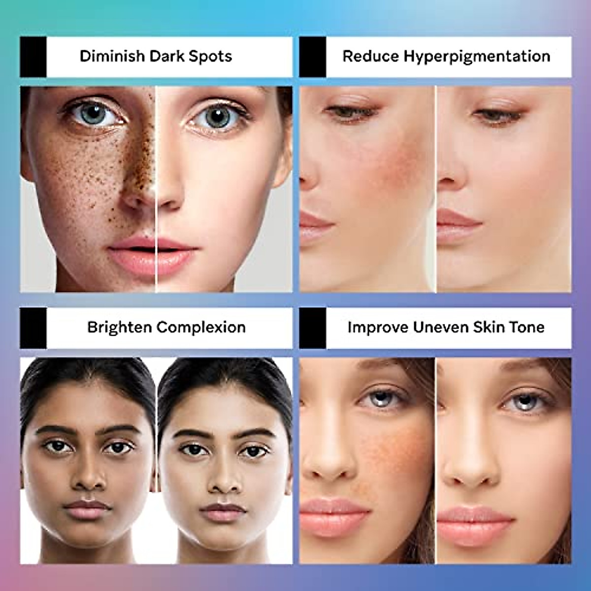 Dark Spot Remover for Face,Dark Spot Corrector Serum,Hyperpigmentation Treatment,Advanced and Natural Formula - - Removes Freckles, Sun Spots, Melasma and More