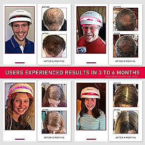 iRestore Essential Laser Hair Growth System - FDA Cleared Hair Loss Treatments for Men & Women & Hair Growth Products for Men with Thinning Hair, Hair Regrowth Treatments Laser Cap, Red Light Therapy