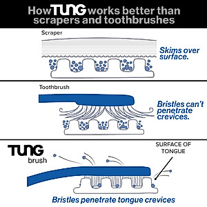 Tung Tongue Gel | Fresh Mint Tongue Cleaning Paste | Bad Breath and Halitosis | Mouth Odor Eliminator | Use with Tongue Brushes & Scrapers | Made in America (2 Pack)