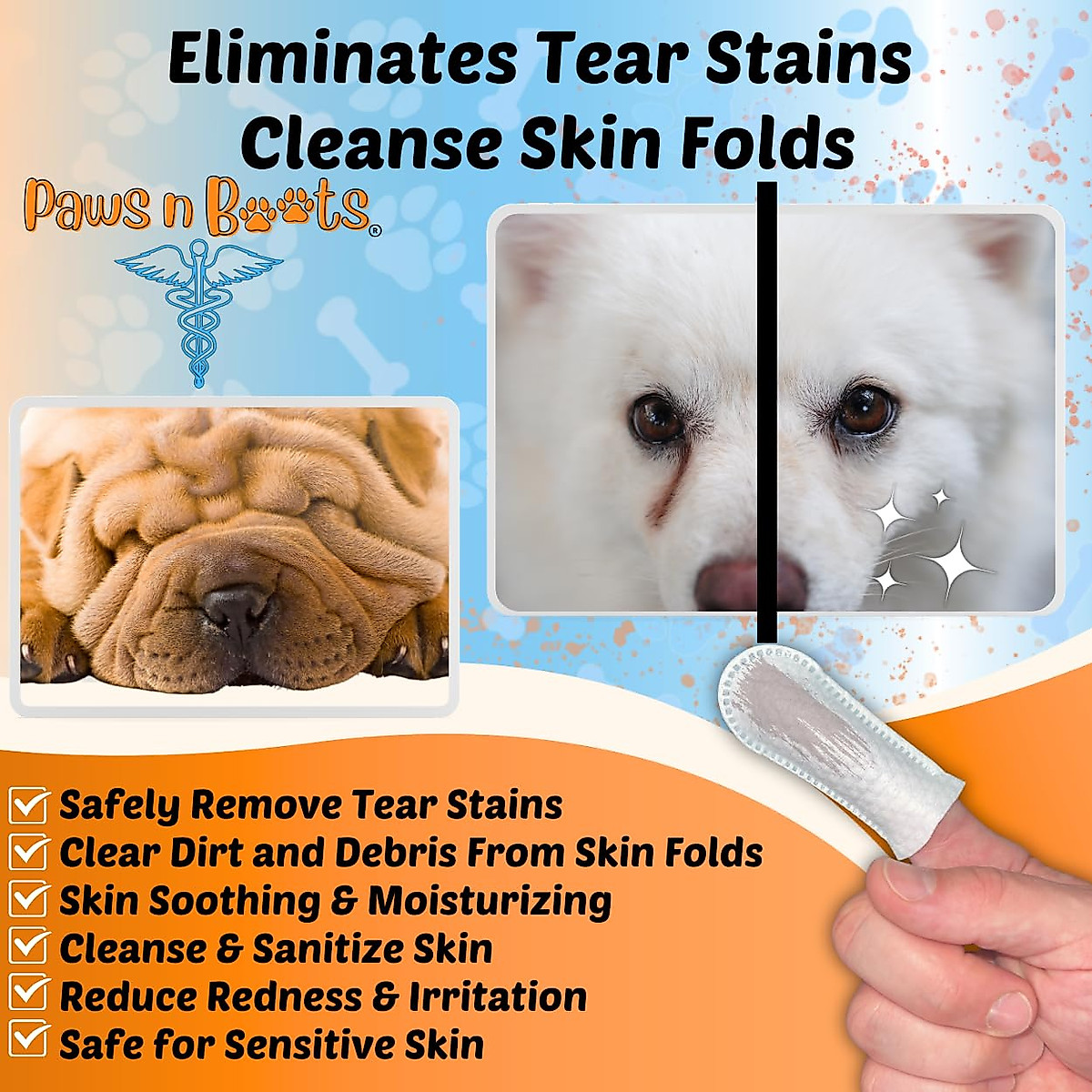 Multi-Purpose All-Natural Pet Finger Wipes, Organic, Safe, Non-Toxic Formulated Pre-Moistened Wipes. Remove Plaque & Whiten Teeth, Clear Ear Wax/Dirt Buildup, Soothe Dry Skin Folds, Remove Tear Stains