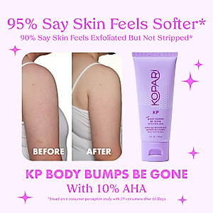 Kopari KP Body Bumps Be Gone Exfoliating Body Scrub with 10% AHA, to Smooth Skin, Reduce Bumps, Decongest Pores, Clarifying, Gently Exfoliate & Wash | 8.45 fl oz Tube