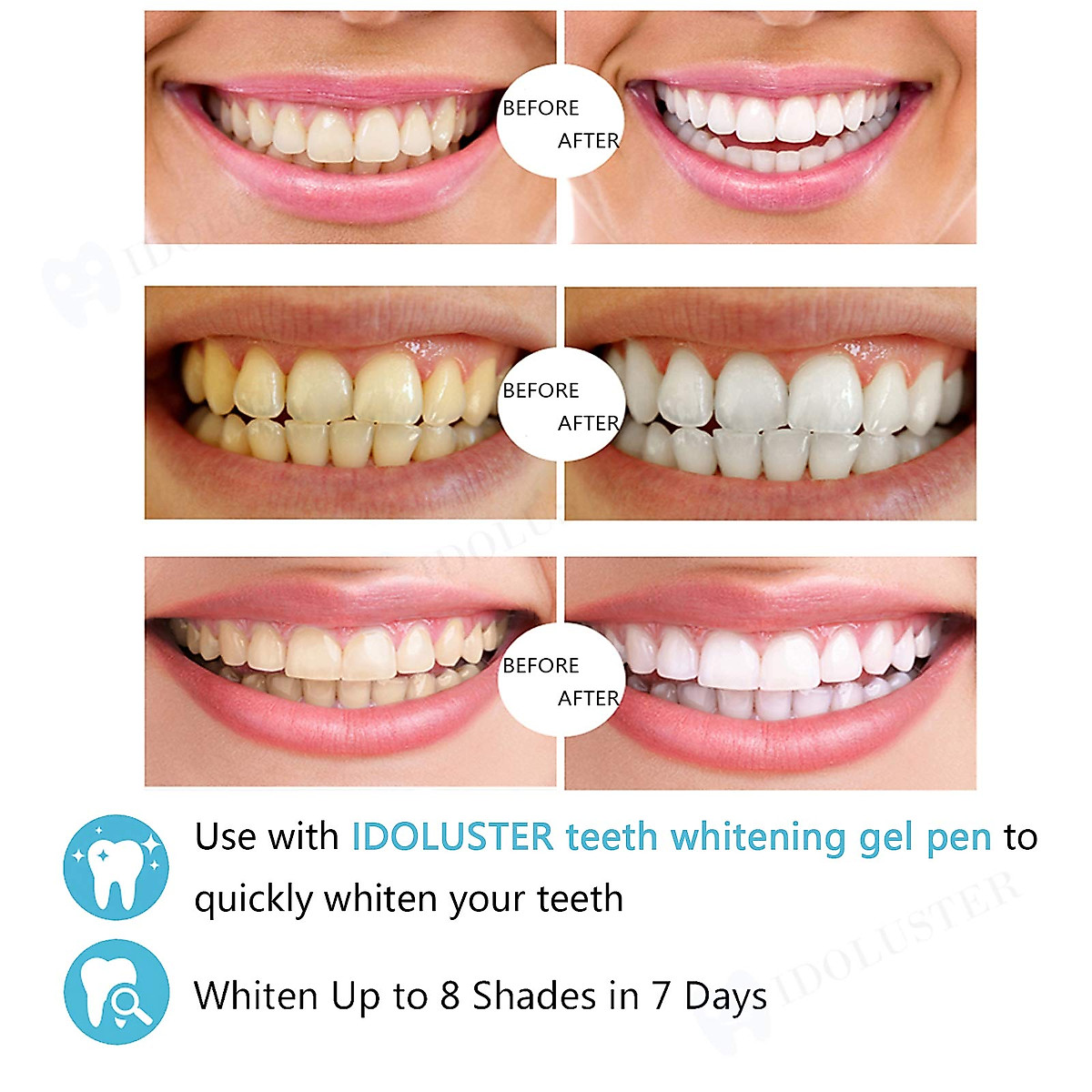 IDOLUSTER Teeth Whitening Accelerator Light, 16X Red & Blue LED Teeth Whitening Light, Powerfull Teeth Light with Comfortable Mouth Tray, Connected with iPhone/Android/USB at Home Use