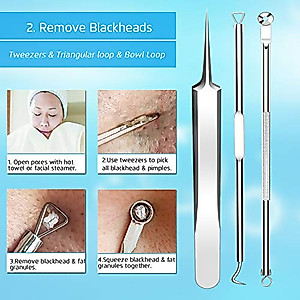 Best Blackhead Remover, Blackheads Blemish Removing, Acne Whitehead Removal Kit, Pimple Comedone Extractor Tool, Popper Pimples Treatment, with Tweezers, Risk Free for Face Forehead Nose