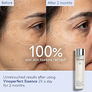 Caudalie Vinoperfect Dark Spot Glycolic Essence with Niacinamide, 5 Fl. Oz