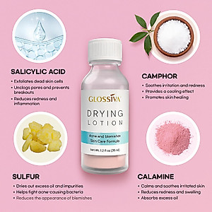 Glossiva Drying Lotion – Acne Spot Treatment, Blemish & Pimple Drying Solution with Overnight Results – 1.23 Fl Oz