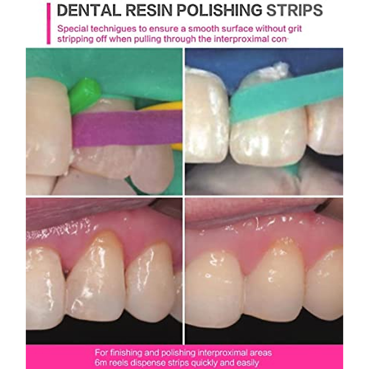 BELEON Dental Polishing Strips - Tooth Polisher Dental File for Teeth Sanding Grinding Deep Teeth Cleaning Tool Tooth Polish Abrasive Strip Oral Care Cleaning Tool - Fine 1 Roll 4mm x 6M