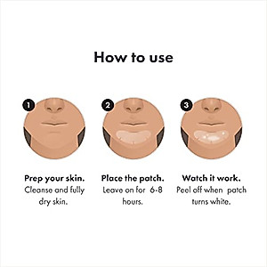 Mighty Patch Chin from Hero Cosmetics - XL Contoured Hydrocolloid Chin Patch for Blemishes and Pimples, Non-Irritating, Vegan-Friendly, Not Tested on Animals (10 Count)