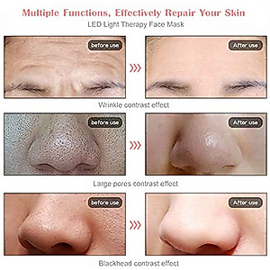 7 Colors Light Portable Face & Neck M -Ask Machine for Home Use | 7 Colors