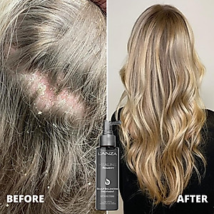 L'ANZA Healing Remedy Scalp Balancing Leave-in Treatment, Restores, Revives, and Nourish Hair & Scalp, Promotes Healthier Hair Growth, Thickness and Density (3.4 Fl Oz)