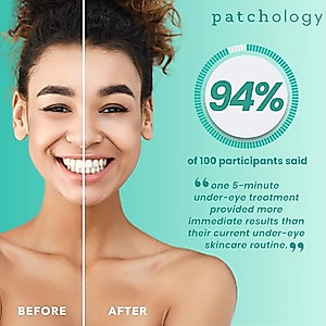 Patchology Eye Gels Patch (5 Pairs) - Natural Eye Patches for Puffy Eyes, Dark Circles and Eye Bags - Eye Mask Skincare for All Skin Types - Beauty & Personal Care Eye Patch