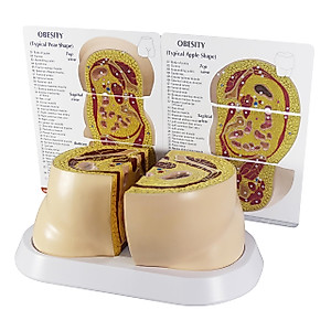 Obesity Model | Human Body Anatomy Replica of Overweight Body Types for Doctors Office Educational Tool | GPI Anatomicals