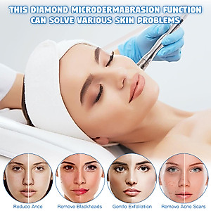 Upgraded 2 IN1 Diamond Microdermabrasion Machine, Beauty Star Professional Diamond Dermabrasion Facial Devices System at Home, Face Pore Cleansing Tool(65-68cmHg Vcuum Suction)