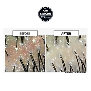 ATS Perstige Bresh Shampoo - 600ML, Oily Scalp and Soothing Silicone Free Shampoo