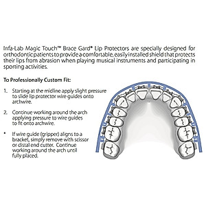 Orthodontic Braces Lip Guard Protector Shield (1 Set - Upper - Lower Teeth) with Instructions by AdentalZ