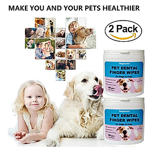 Dog Teeth Cleaning Wipes - 2 Pack | 100 Count, Dental Wipes for Dog Teeth, Pet Tooth Brushing kit Finger Wipes for Dogs & Cats - Reduces Plaque & Freshens Breath