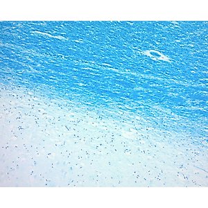 Luxol Fast Blue Stain Pack, 125ml