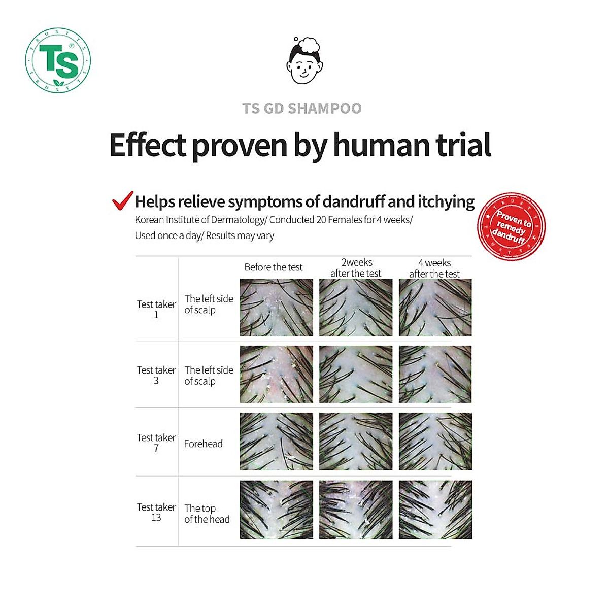 TS GD Shampoo for Dandruff & Itchy Scalp (13.5 Oz) Youth & Teen Shampoo | Treatment for Adolescents | Allergen free | Silicone,SLS,SLES Free | Korean Shampoo