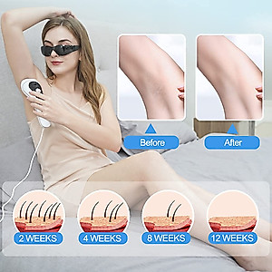AOHEKANG At-home Laser Hair Removal for Women, IPL Hair Removal Device ICE Permanent Painless Hair Remover for Facial Armpits Bikini Legs, Upgraded to 999,999 Flashes