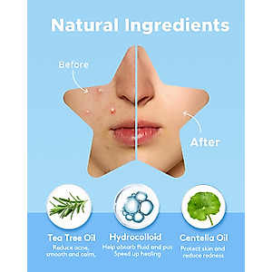 LitBear Acne Patch with Tea Tree & Centella Oil, 168 Hydrocolloid Dots in 6 Colors for Face - Cute Star Pimple Stickers