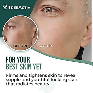 TreeActiv Retinol Cream, 2 oz, Retinol Cream for Face and Body, Gentle Retinol Moisturizer with Hyaluronic Acid, Moisturing Women and Mens Retinol Face Cream, Anti Aging Spot Wrinkle Cream, 400 Uses