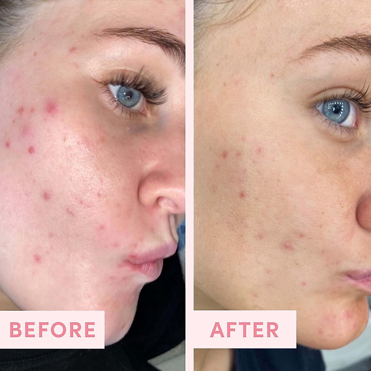 Sand & Sky Flash Perfection Exfoliating Treatment Face Scrub - Face cleanser Australian Pink Clay Moisturizing Facial Exfoliator For Face | With Rosehip, Grapeseed, Olive Oil (3.4 oz)