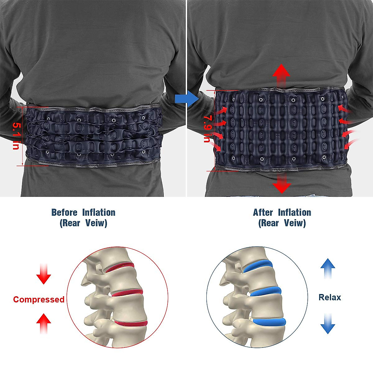 HONGJING Decompression Back Belt for Lower Back Pain Relief- Spine Reset Device Lumbar Support for Lifting, One Size Fits 29-49 Waist