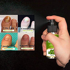 Essential Oil of Oregano - New Atomizer 2Oz Large 100% Pure Undiluted, Non GMO, Oregano Oil - Best Carvacrol