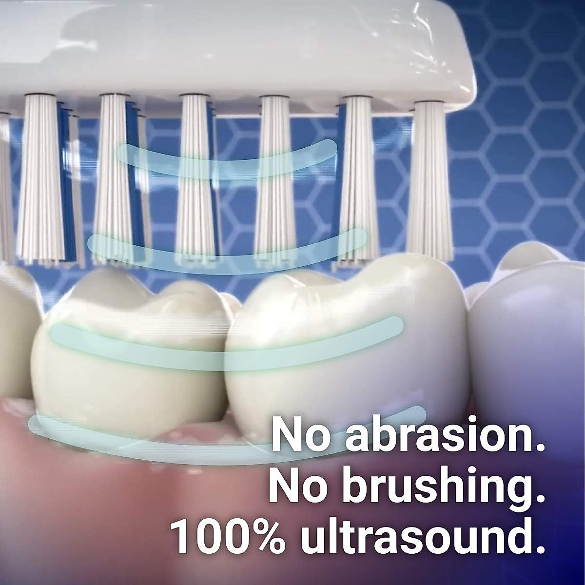 Emmi-dent Electric Ultrasonic Toothbrush Set with Gentle 100% Ultrasound Cleaning Technology. Ideal for Sensitive Teeth & Gums, Plaque Removal and More! Includes Nano-Bubble Toothpaste. Rechargeable.