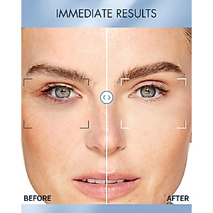 depology Replenish & Repair Under Eye Patches for Puffy Eyes, Wrinkles (60 Patches) | Hydrating with Ceramides and Hyaluronic Acid for All Skin Types | Botanical Extracts Eye Gel Pads 2.96 fl oz