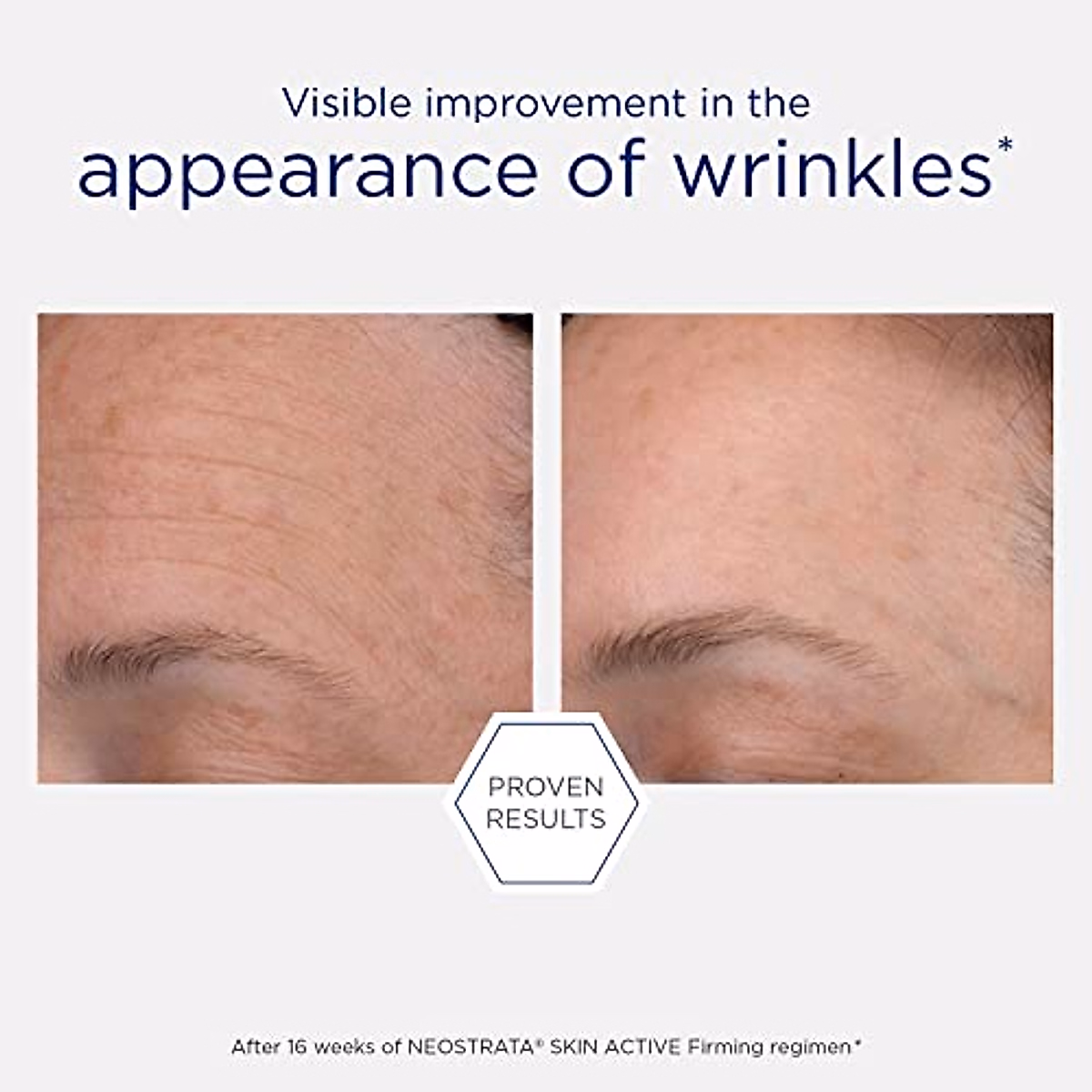 NEOSTRATA Cellular Restoration Face Cream With Glycolic Acid, Peptides and Antioxidants for Dry Skin Non-comedogenic, 1.7 Ounce (Pack of 1)