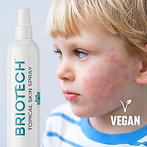 BRIOTECH Topical Skin Spray, Hypochlorous Acid Spray for Body & Face, Eyelid Cleanser, HOCl Facial Mist, Support Against Irritation, Calm Redness, Soothe Scalp, Packaging May Vary, 4 oz ea, 2 ct