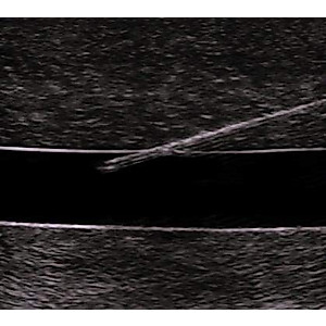Ultrasound Central Line Training Model - CVL Phantom for Practice