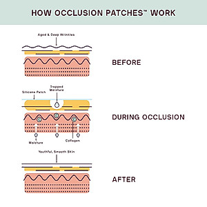 Dermaclara Silicone Fusion Anti-Wrinkle Patches - Reusable Face Treatment Kit for Fine Lines, Under Eye, Forehead & Neck Wrinkles - Pregnancy Safe Skincare - Facial Silicone Patches for Wrinkles