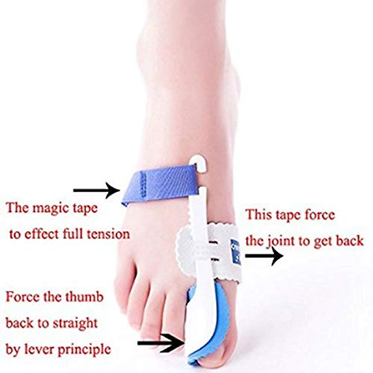 AnHua Valgus Bunion Corrector Orthotics Feet Bone Thumb Adjuster Correction Pedicure Sock Straightener Bunion Splint for Bunions For Crooked Toes Alignment Pain Relief (Style2：Blue white)