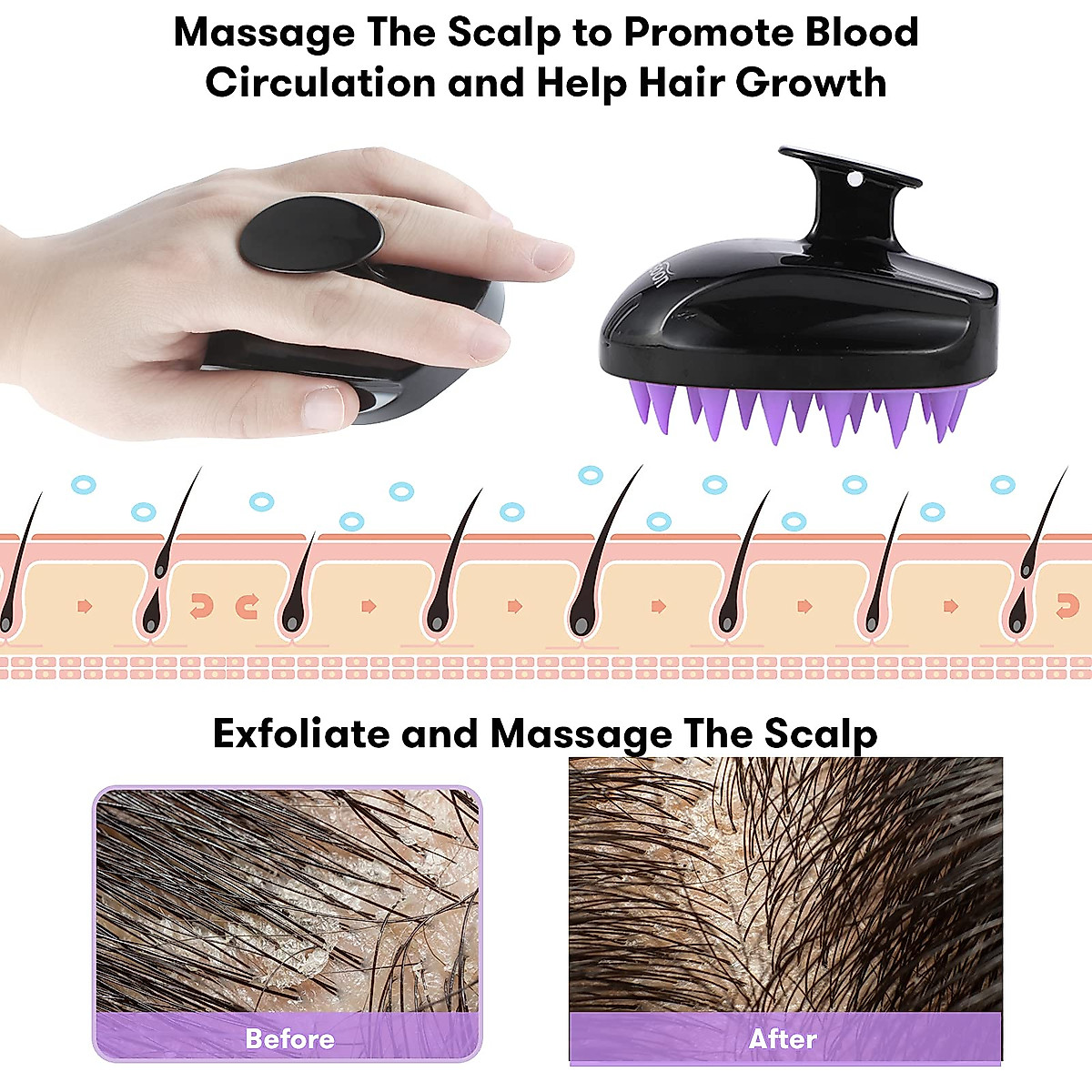 Scalp Massager, Shampoo Brush Hair Scrub Brush for Wet and Dry Hair, Soft Silicone Bristles Head Massager Clean Hair, Reduce Dandruff, Massage Scalp, Promote Hair Growth