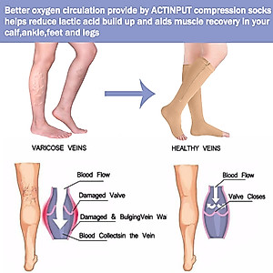 2 Pairs Compression Socks Toe Open Leg Support Knee High Socks with Zipper (Nude+Black, S/M) …