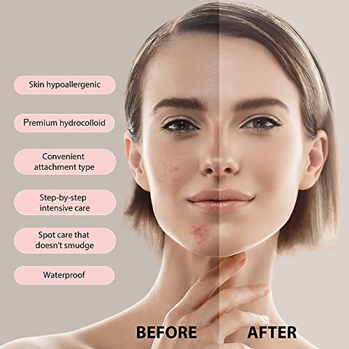 HARUTO Acne Pimple Patches XL (10 patches/1 pack) - Hydrocolloid Large acne Patches Spot Treatment, Tea tree spot patch, acne sticker for Body and Larger Breakouts,