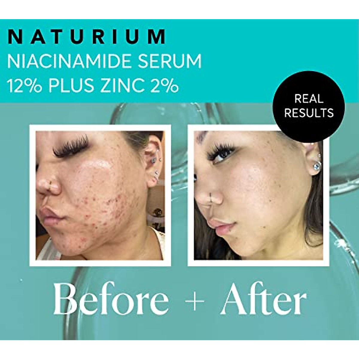 Naturium Niacinamide Face Serum 12% Plus Zinc 2%, Hyaluronic Acid & Vitamin E, Pore Minimizer, Discoloration & Aging Skin Treatment, 1 oz