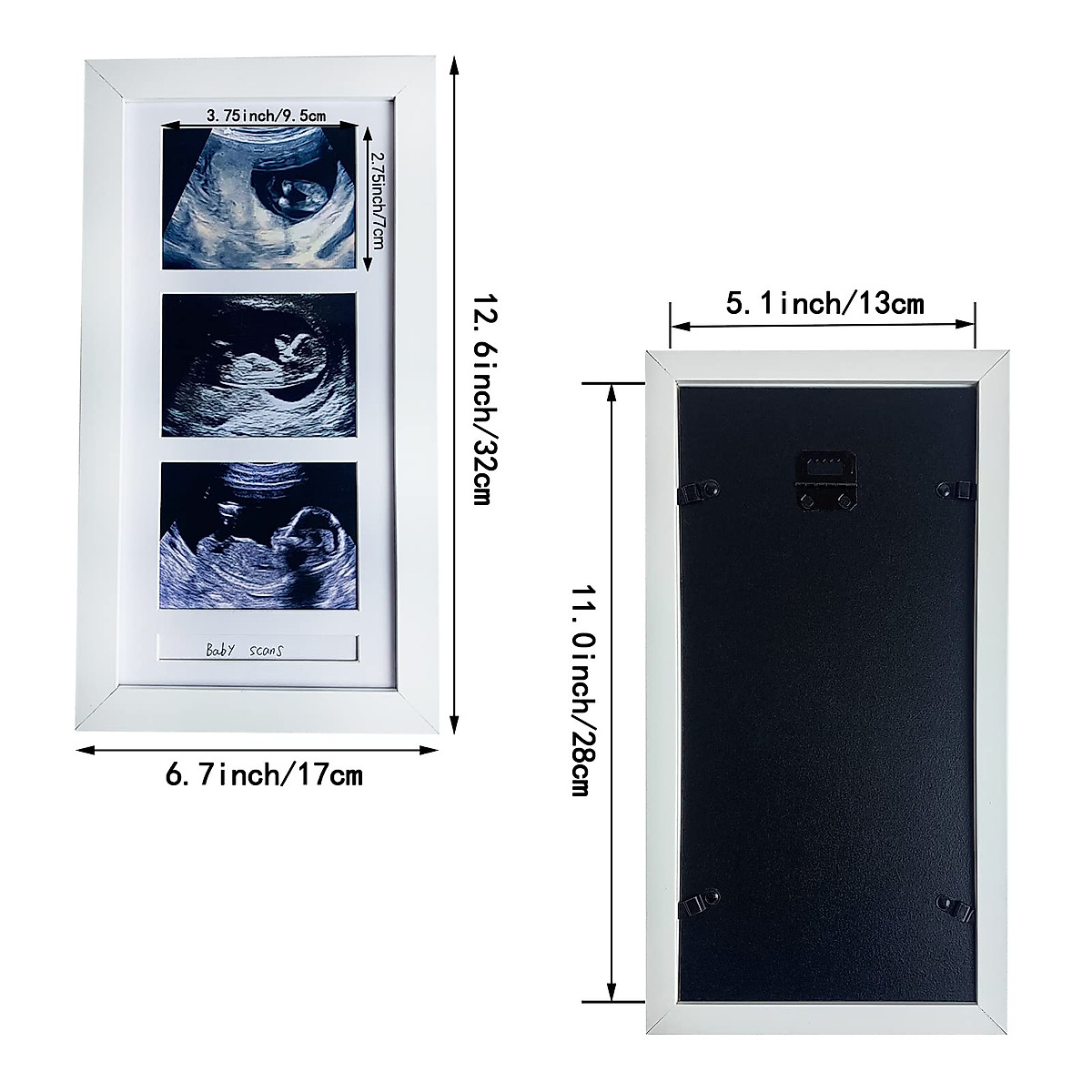trlry Triple Ultrasound Picture Frames, Sonogram Picture Frame 3 Photos,Pregnancy Announcements,Pregnancy Gifts for First Time Moms,First Time Mom Gift,White,Ultrasound Photo Album