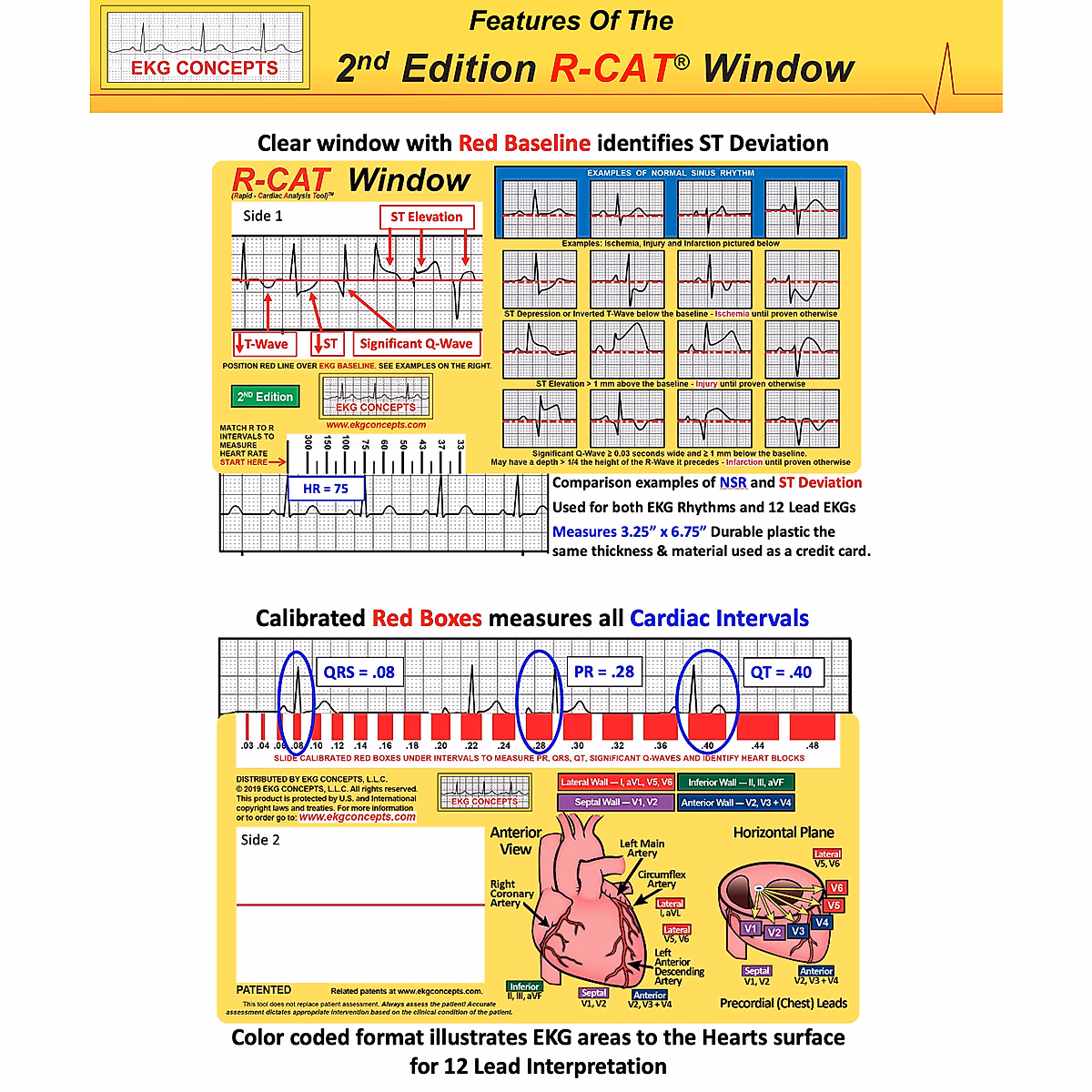 R-CAT EKG Window 2nd Edition
