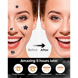 LitBear Acne Patch Pimple Patch, Black Star & Heart Shaped Acne Absorbing Cover Patch, Hydrocolloid Acne Patches For Face Zit Patch Pimple Sticker Acne Dots, Tea Tree Oil + Centella (108 Count)