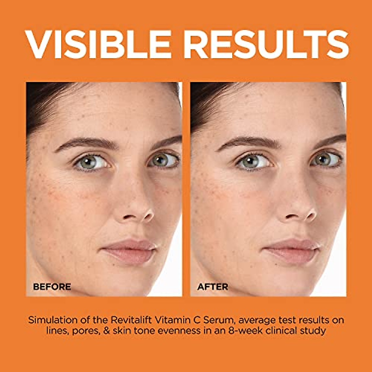 L'Oreal Paris Revitalift 12% Pure Vitamin C Serum, Vitamin E, Salicylic Acid, Moisturizing, Smoothing & Brightening, Non Greasy + Moisturizer Sample