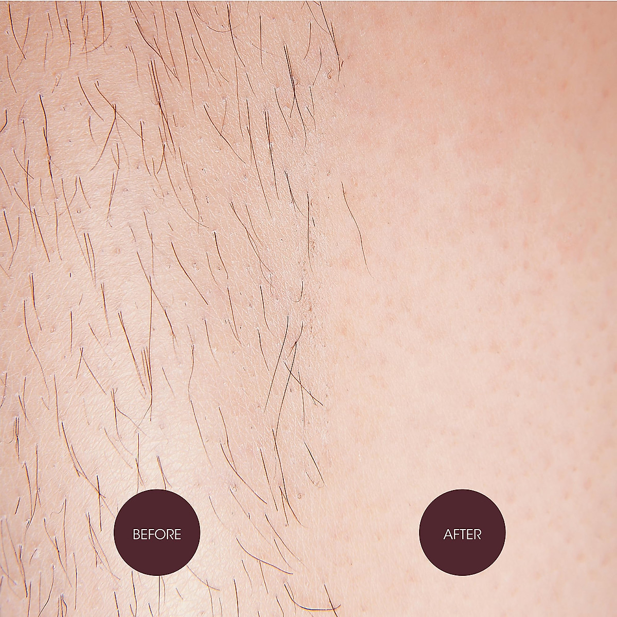 Nad's Brazilan & Bikini Wax Kit, Hair Removal For Women, Body Wax Specifically For Coarse Hair, At Home Waxing Kit With Hard Wax + Calming Oil Wipes + Wooden Spatula