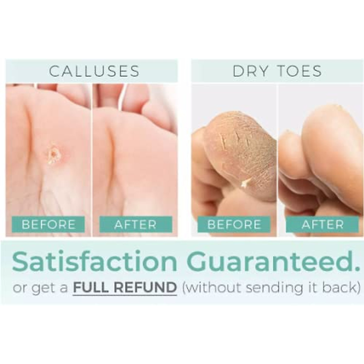 Peach Foot Peel Mask - Repair Cracked Heels, Remove Dead Skin. Makes Your Feet soft And Beautiful