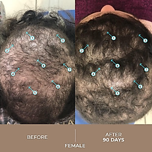 Spectral.DNC-N Hair Thickening, Strengthening Hair Serum for Men and Women by DS Laboratories - Supports Hair Growth, Minimize Shedding, Experience Thicker, Fuller, Stronger Hair, Color Safe (2 fl oz)