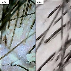 Briogeo Scalp Revival Megastrength Dandruff Shampoo, Charcoal + AHA/BHA with Salicylic Acid 3%, Anti-Dandruff Shampoo to Soothe a Dry, Flaky, Itchy Scalp, Vegan, Cruelty-Free, 8.4 fl oz