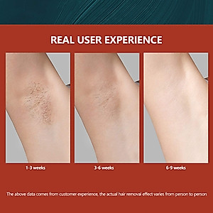 Hair Removal Machine, 808 Semi-Conductor Laser Hair Removal Machine Mini Portable Ice Compress Depilation Instrument(US)