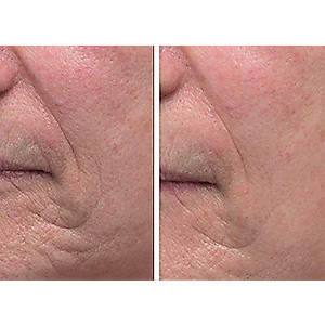 Dr. Denese SkinScience Firming Facial Collagen Night Serum Increased Elasticity, Tone, Tightness with Hyaluronic Acid, Glycolic Acid, Squalene & Botanical Extracts - Paraben-Free, Cruelty-Free - 3.4oz