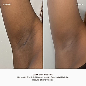 Bushbalm Dark Spots and Ingrown Hair 2 Step Routine - Rejuvenate and Nourish - Ingrown Hair Oil (30 ml) and Exfoliating Scrub (236 ml) - Bermuda