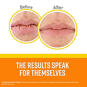 O'Keeffe's Lip Repair SPF 35 Lip Balm Stick, (Pack of 1)